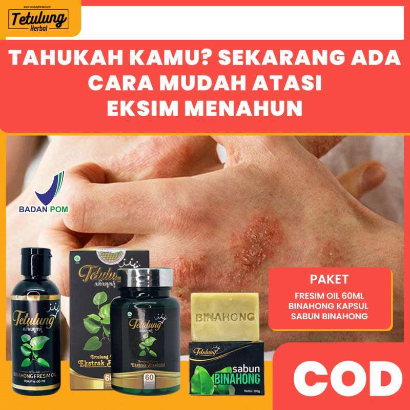 Jual Tetulung Binahong Atasi Gatal Menahun Fresim Oil 60ml Kapsul Isi