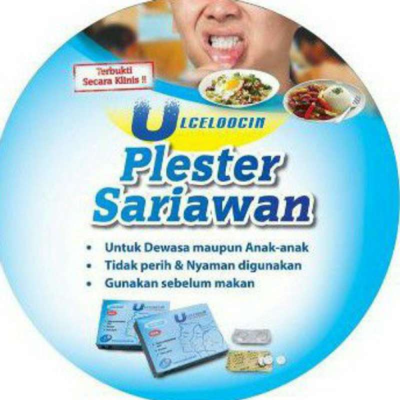 Jual Plester Sariawan Ulceloocin Di Seller Genevieve Health Shop ...