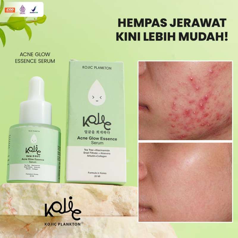 Promo Serum Acne Glow Essence By Kojic Plankton Diskon 55% Di Seller ...