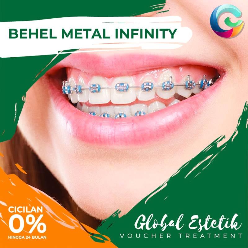 Jual Behel Metal Terbaik - Harga Terbaru 2026