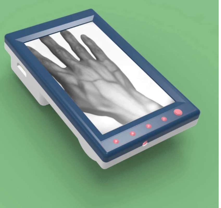 Jual Medical Vein Imaging Device Veinpuncture Using Vein Viewer Vein ...
