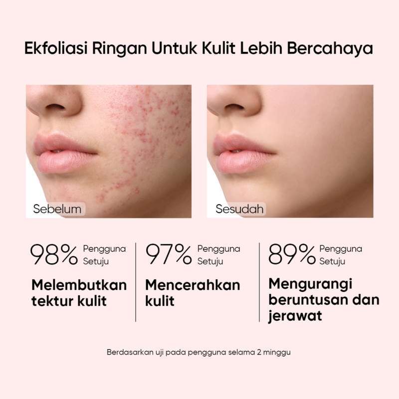 Promo [bpom Na] Skintific Glycolic Acid Daily Clarifying Toner 80ml ...