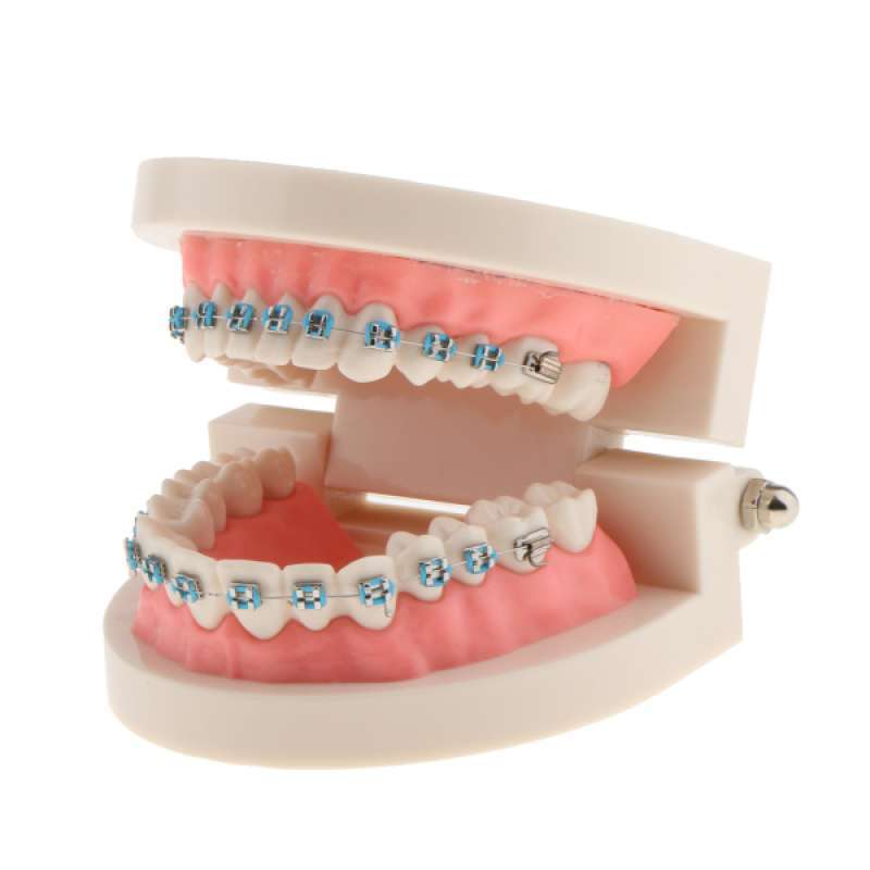 Promo Dental Teach Study Orthodontic Tooth Teeth Model with Metal ...