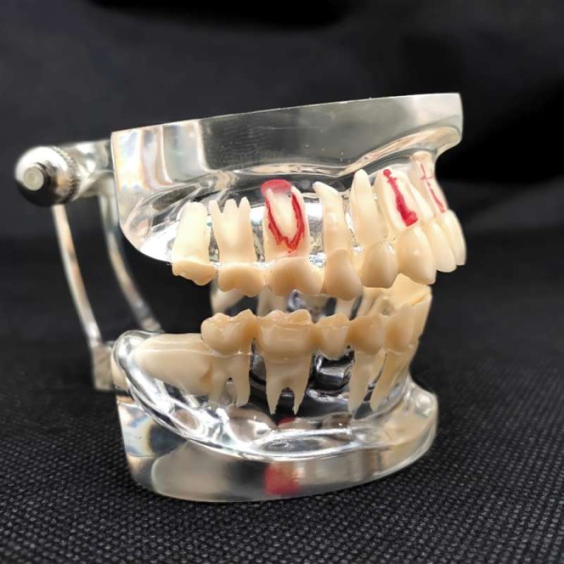 Jual Study Model Gigi Transparan / Phantom Gigi Atas Bawah Di Seller ...