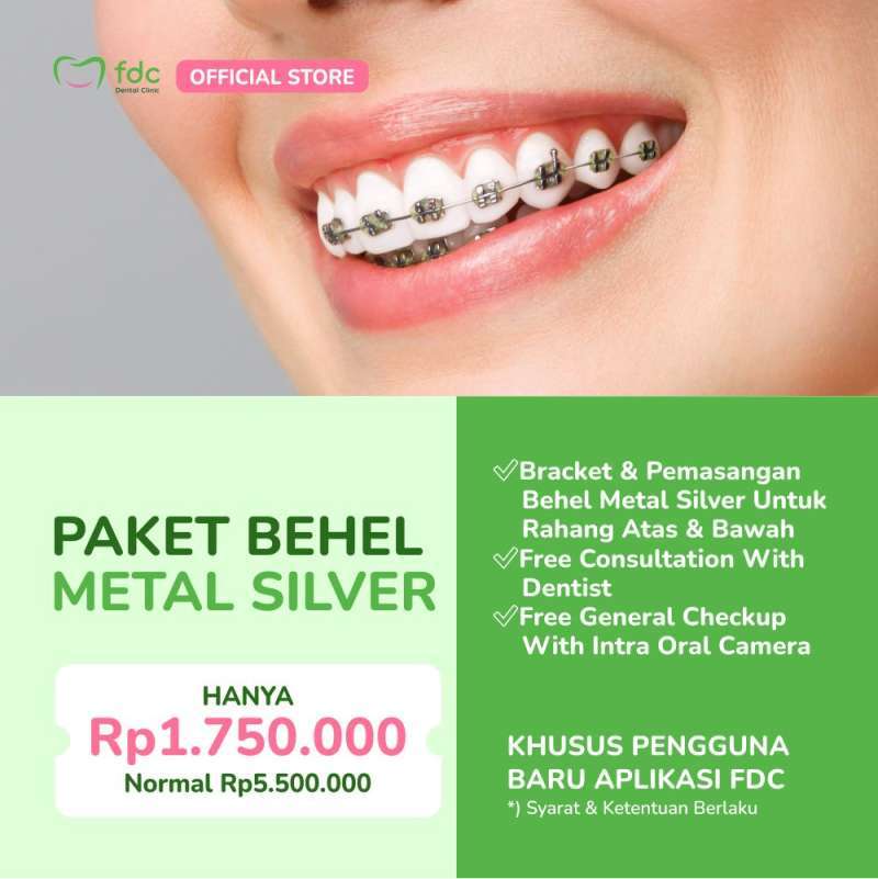Jual Fdc Dental Clinic Bandung - Pemasangan Behel Gigi/ortho/kawat Gigi ...