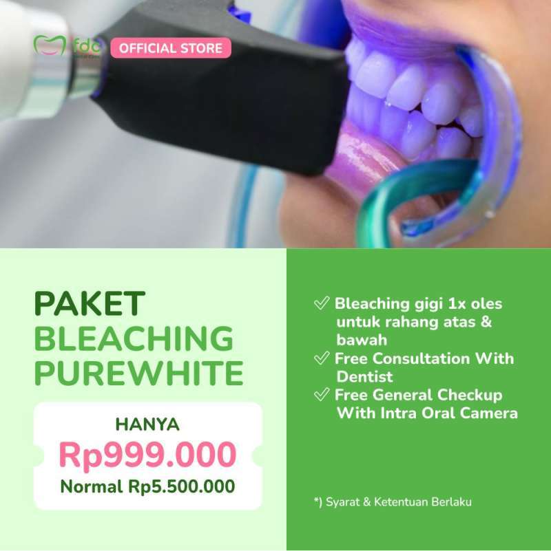 Jual Fdc Dental Clinic Bandung - Memutihkan Gigi/bleaching Gigi ...