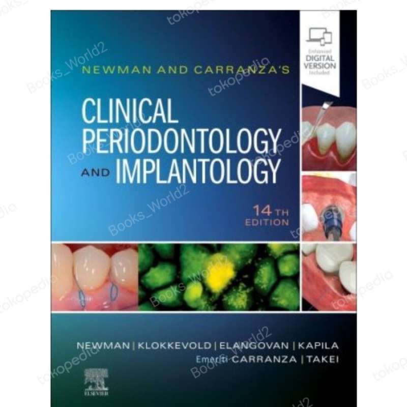 Jual Buku Newman And Carranza's Clinical Periodontology And Implantology Di Seller Noelle ...