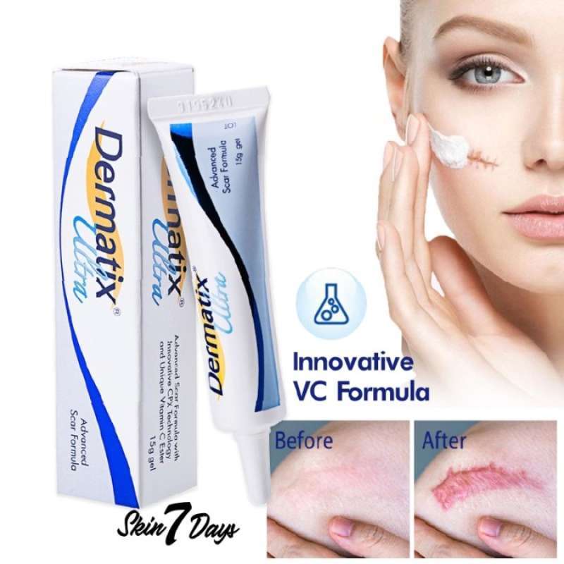 Jual Dermatix Cream Obat Penghilang Bekas Luka Keloid Anti Scar ...