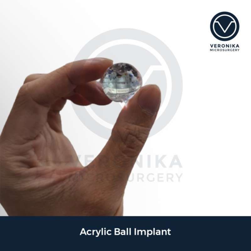 Promo Acrylic Ball Implant / Implan Akrilik Bola Mata Diskon 23% di ...