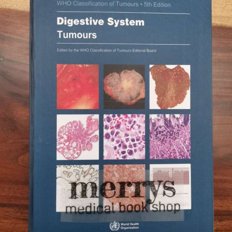 Promo Who Classification Of Tumours Of Digestive System Tumours Diskon ...