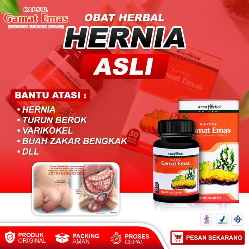 Jual Obat Hernia Turun Berok Usus Peranakan Pria Wanita Dewasa Hidrokel ...