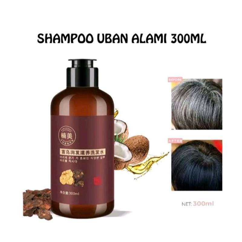Shampo Uban Terbaik Lengkap Harga Terbaru April 2024 | Blibli