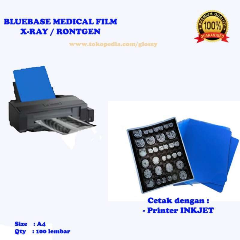 Promo Medical Film / Rontgen / X-ray - Inkjet Diskon 23% Di Seller ...