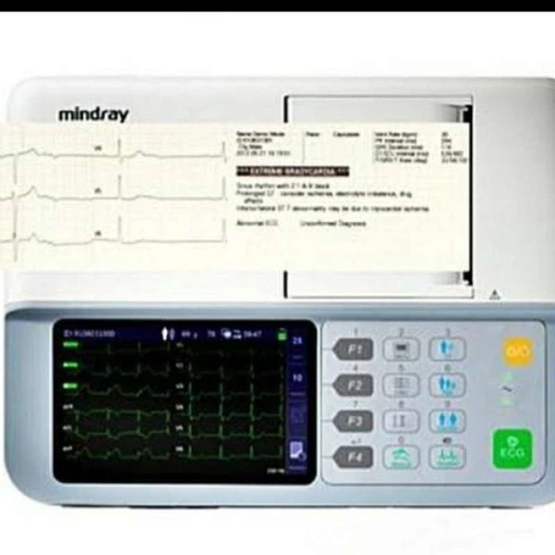 Promo Mindray (china) Electrocardiography Diskon 33% Di Seller Lucky ...