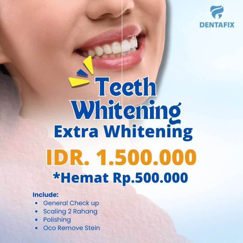 Promo Teeth Whitening Extra Whitening Diskon 25% Di Seller Dentafix ...