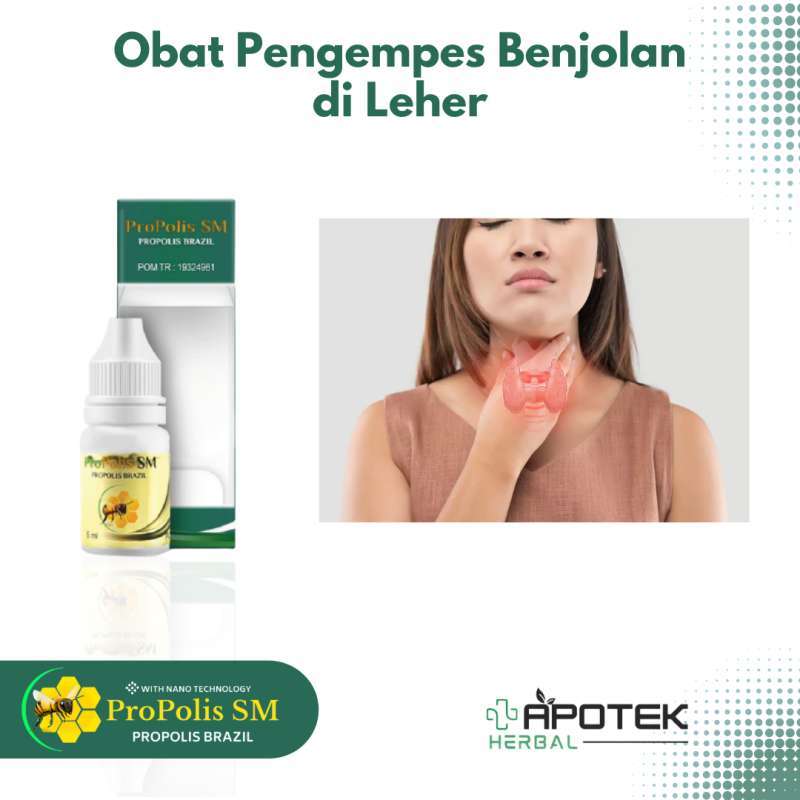 Jual Propolis Sm 6ml - Obat Benjolan Di Leher Kelenjar Getah Bening ...