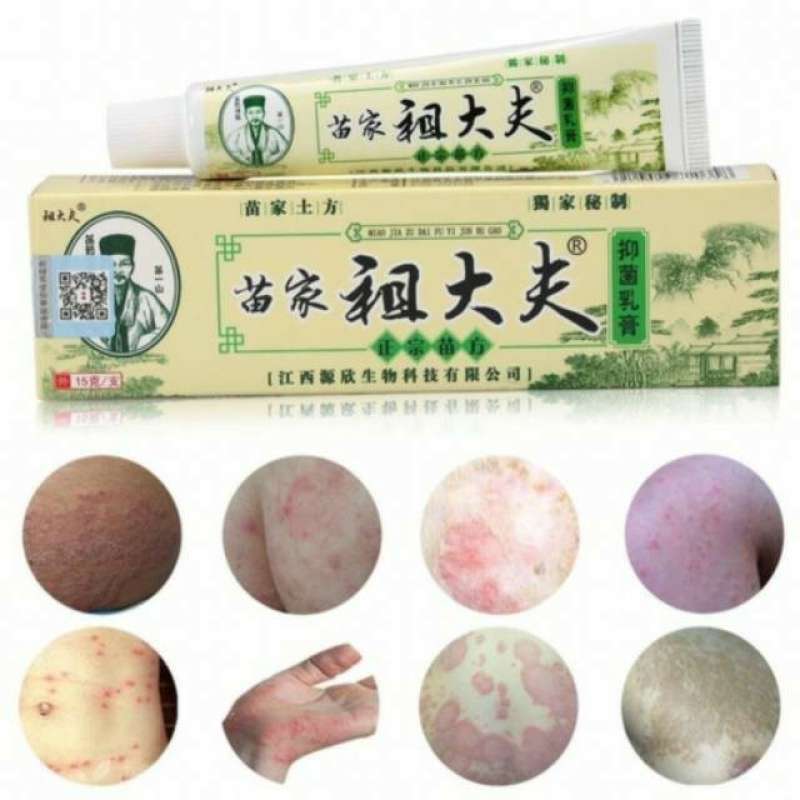 Obat Gatal Cina Lengkap Harga Terbaru Januari 2024 | Blibli