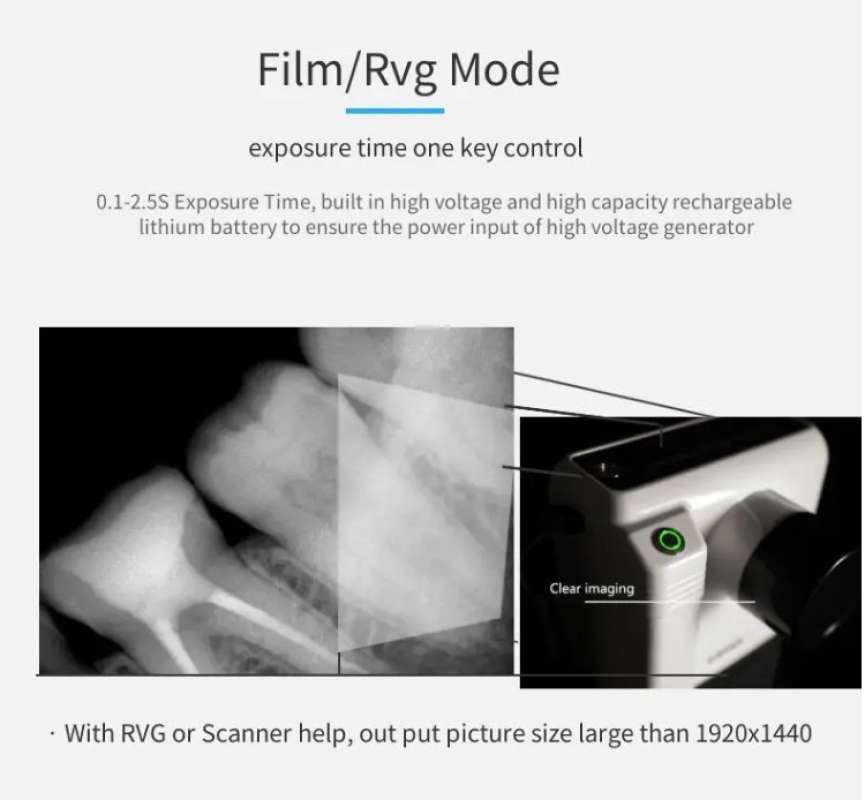 Jual Dental X-ray Digital Medical Machine With Handy Rvg Sensor Di ...