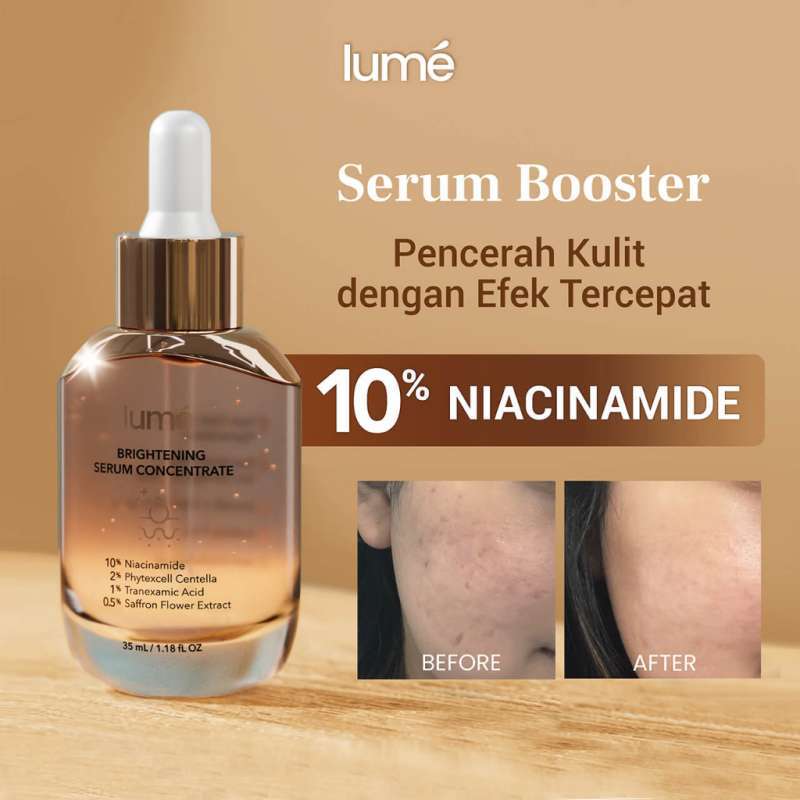 Jual Lume Brightening Serum Concentrate Di Seller Lumecolors Yukma ...