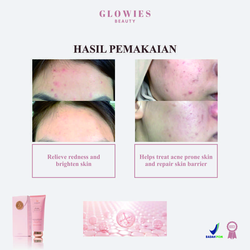 Jual Sunshine Package | Dreamy Moisturizer Glowies Beauty | Glowies ...