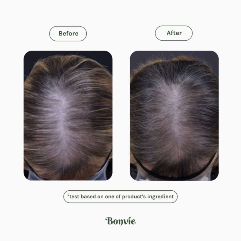 Jual Bonvie Kemiri Serum Shampoo 250ml Treatment Oil Vitamin Rambut Di ...