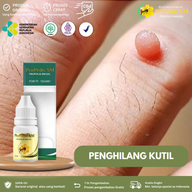 Obat Papiloma Lengkap Harga Terbaru Mei 2024 | Blibli