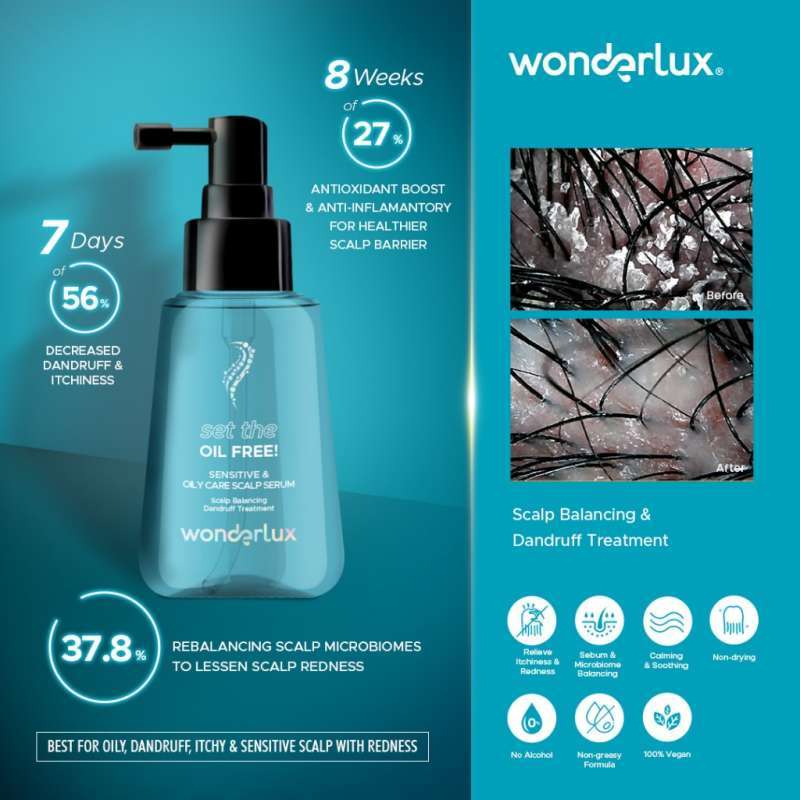 Jual Wonderlux Set The Oil Free! Sensitive & Oily Care Scalp Serum Di ...