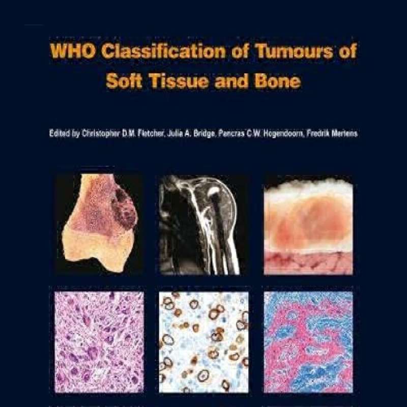 Promo [full Color /bw] Who Classification Of Tumours Of Soft Tissue And ...
