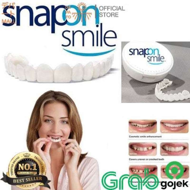 Jual Snap On Smile Authentic / Gigi Palsu Snapon Smile 1 Set Veneer Gigi Di Seller Aghanim ...