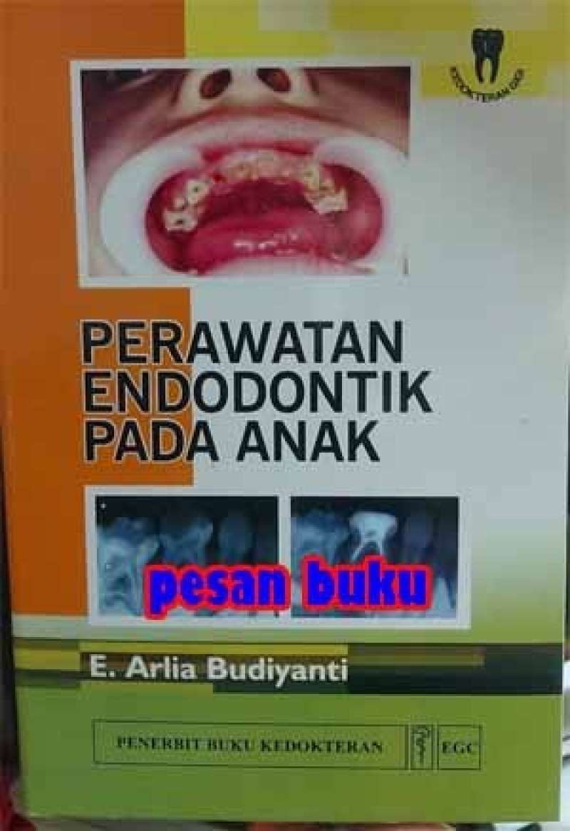 Promo Buku Perawatan Endodontik Pada Anak - E. Arlia Budiyanti Diskon ...