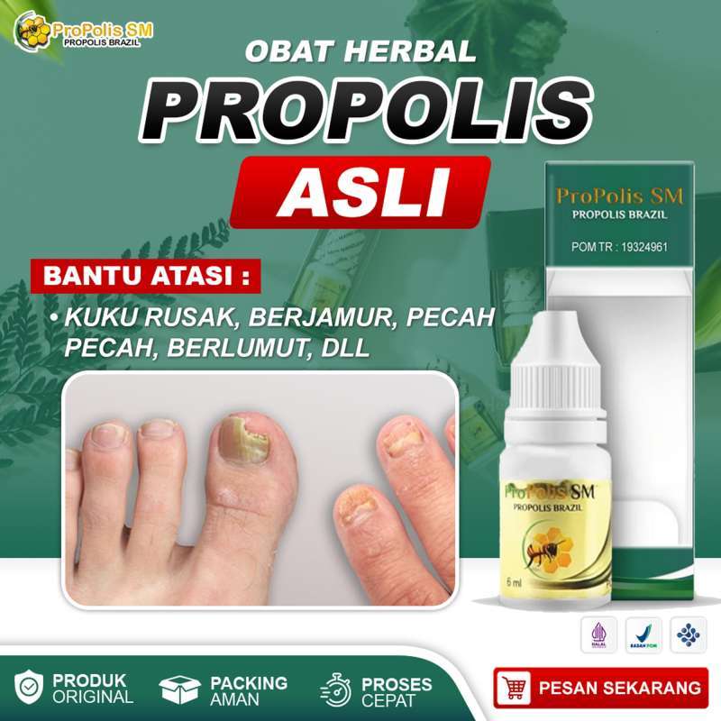 Promo PROPOLIS SM, Obat Kuku Rusak Berjamur, Serum Obat Penhilang Jamur ...