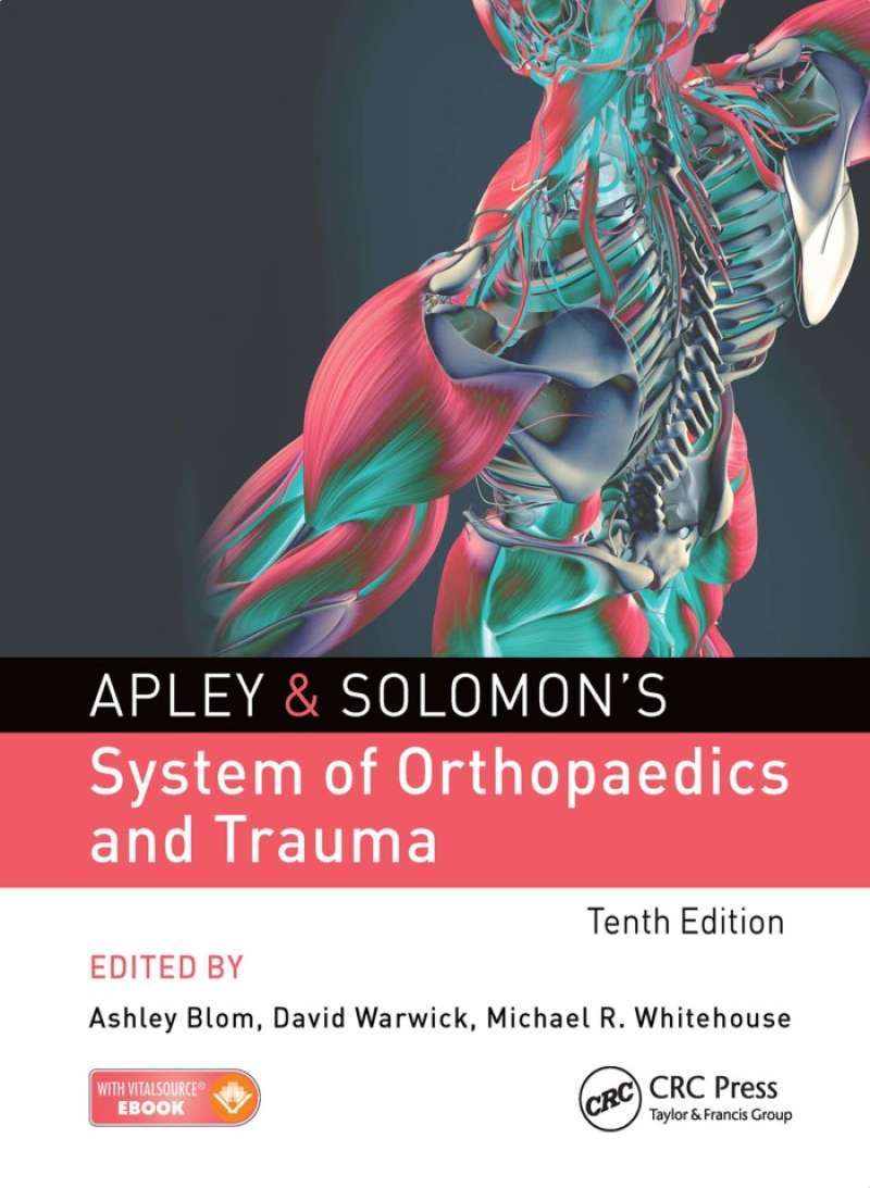 Jual Apley And Solomon System Of Orthopaedic And Trauma 10e, 2018 Di ...