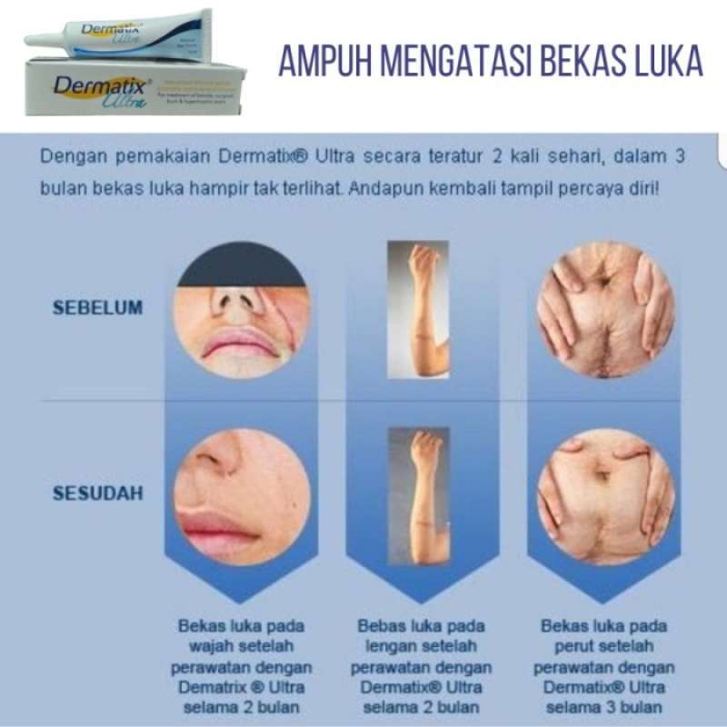 Jual Dermatix Ultra Gel Salep Penghilang Luka 15gr Advanced Scar ...