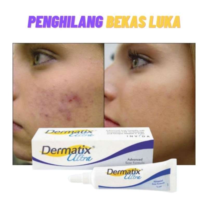 Jual Dermatix Ultra Gel Salep Penghilang Luka 15gr Advanced Scar ...