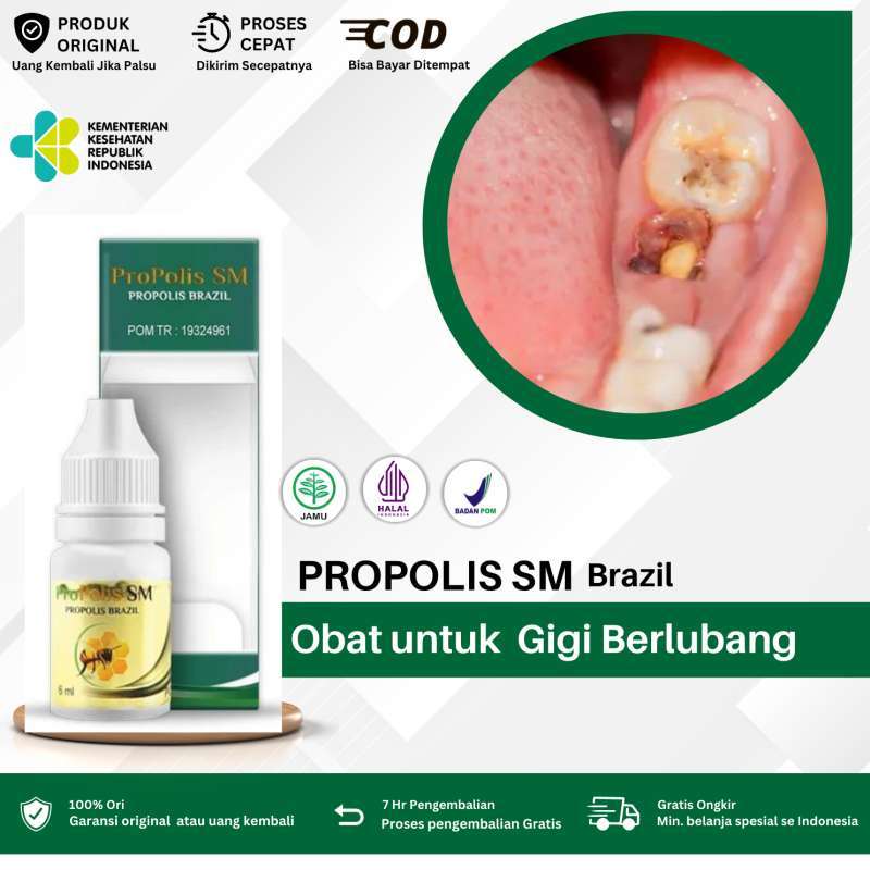Jual Obat Sakit Gigi Berlubang Untuk Anak dan Dewasa Radang Gusi Bengkak Atasi Sariawan Di Bibir ...