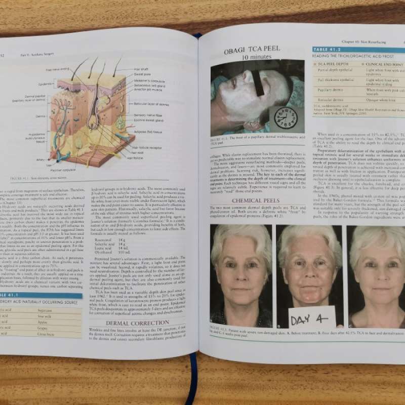 Jual Buku Kedokteran Grabb And Smith's Plastic Surgery 7e - Isi Hitam ...