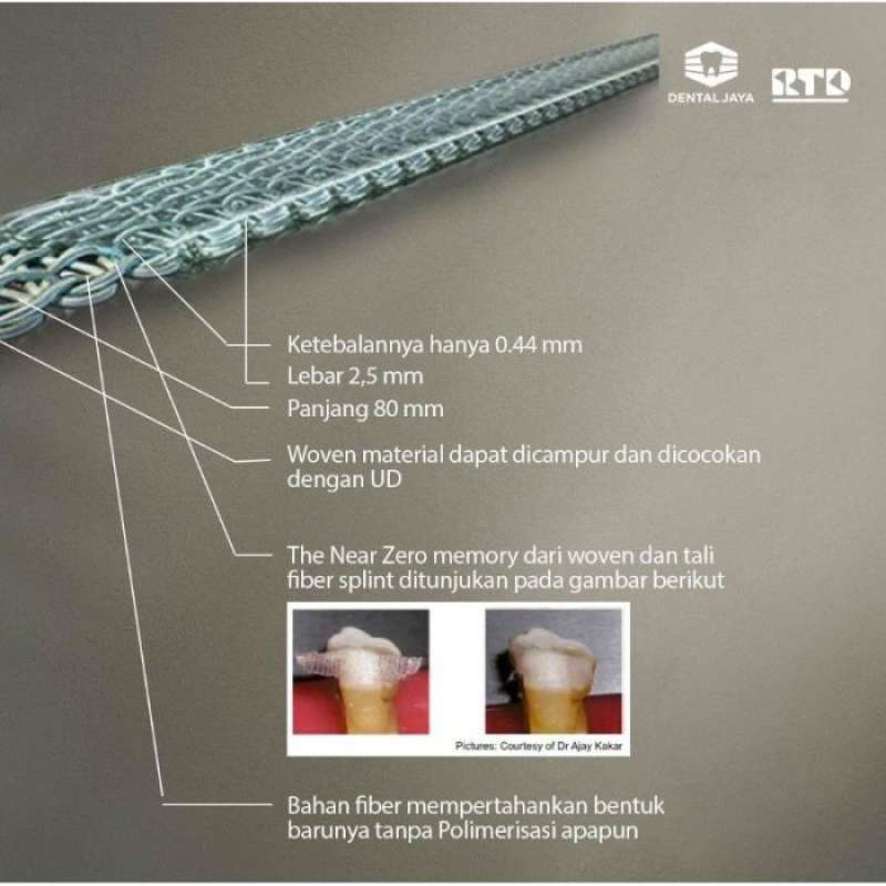 Promo Dental Jaya Fiber Splint / Fiber Reinforced / Splinting Diskon 23 ...