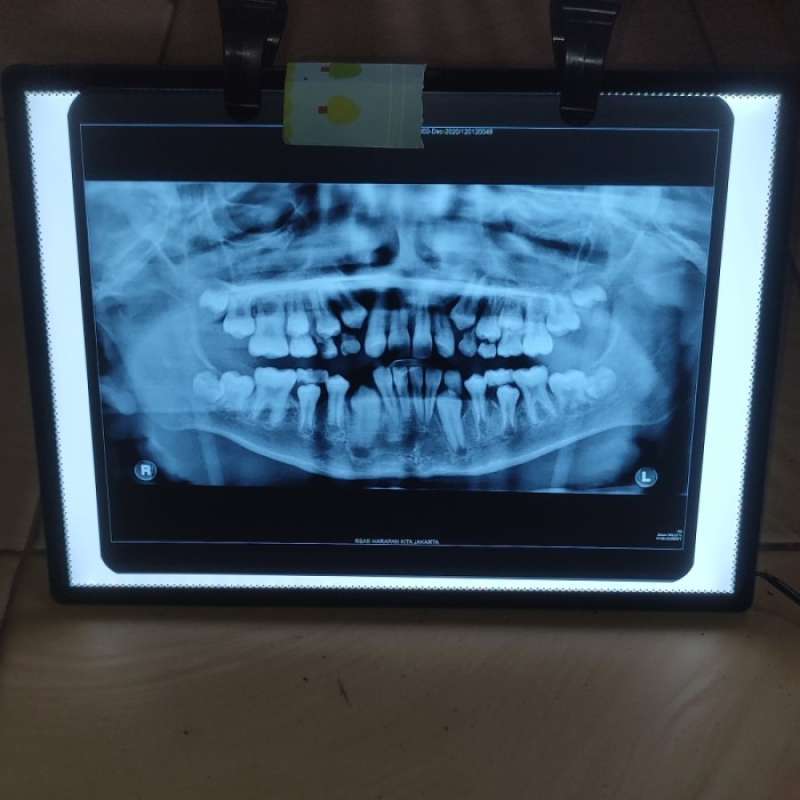 Promo Dental viewer X ray LED rontgen A4 slim / lampu baca rontgen ...