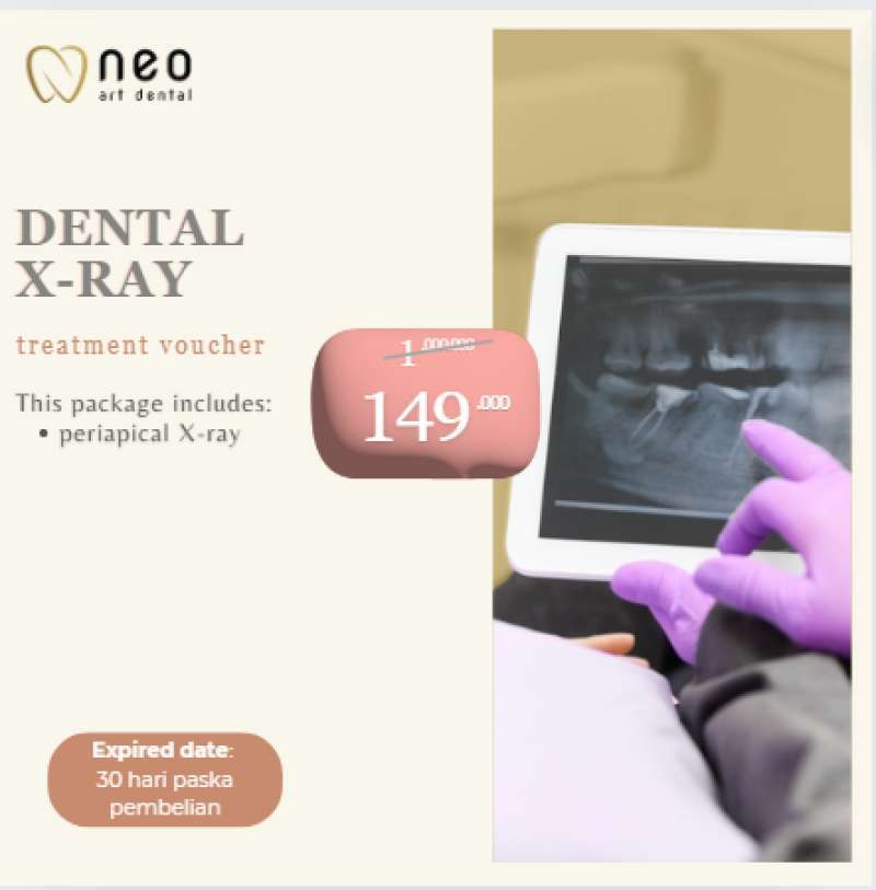 Jual Neo Art Dental - Voucher Rontgen Periapical Di Seller Neo Art ...