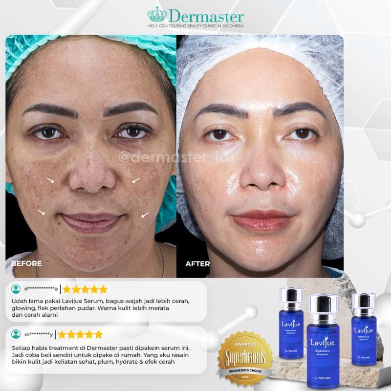 Jual Dermaster Lavijue Serum - 15 Ml Di Seller Dermaster Shop - Petojo Selatan, Kota Jakarta ...