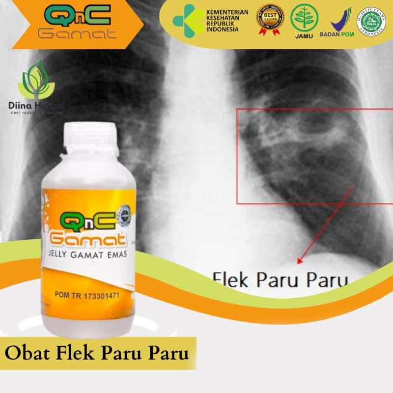 Jual Obat Flek Paru Paru, Obat Pneumonia, Obat Radang Paru Paru, Obat ...