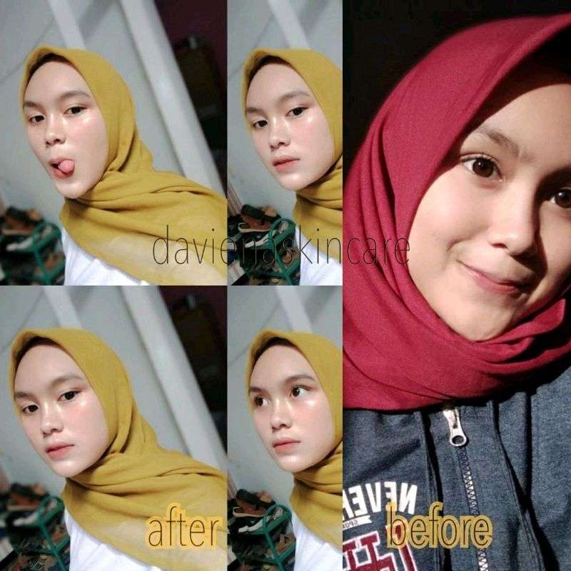 Promo Daviena Skincare Paket Glowing Series Lengkap Original Diskon 3% ...