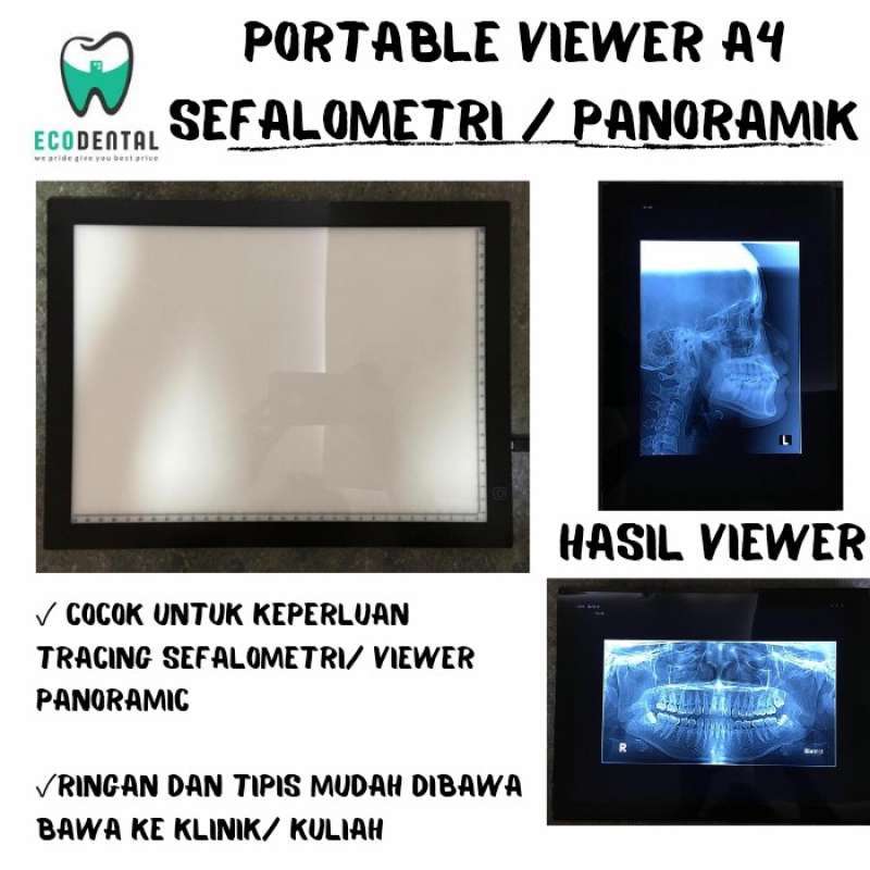 Promo Viewer Rontgen X-Ray Gigi Portable Slim Tracing Sefalometri ...