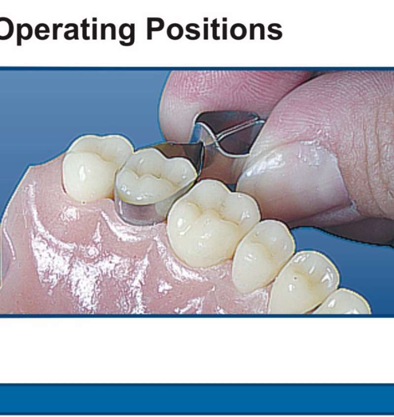 Promo Dental Matriks Pre molar / Premolar matrix - Multicolor Diskon 23 ...