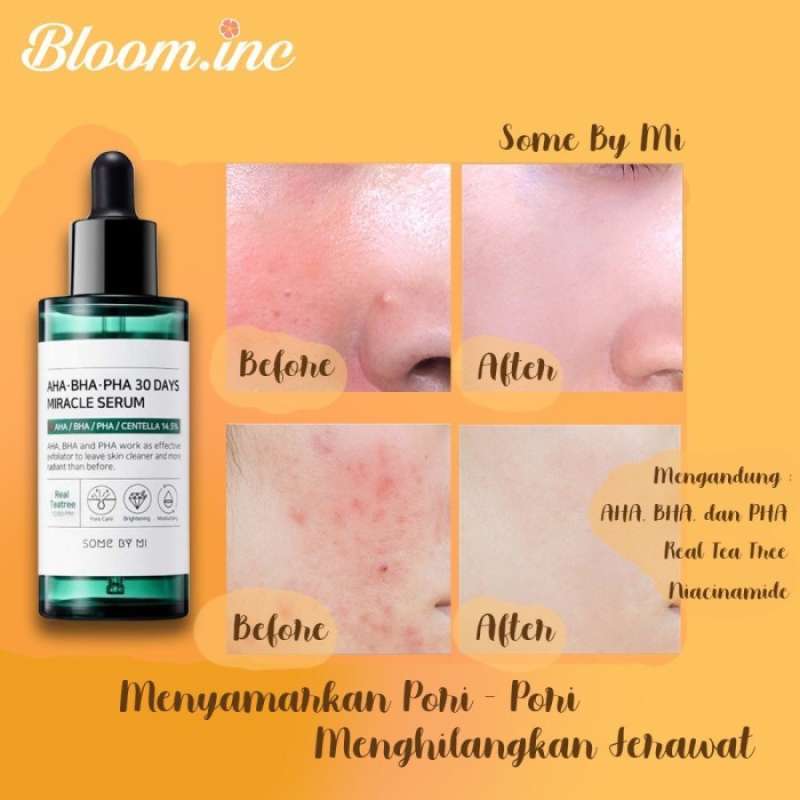 Promo Authentic Somebymi Aha Bha Pha 30 Days Miracle Serum 50 Ml Diskon ...