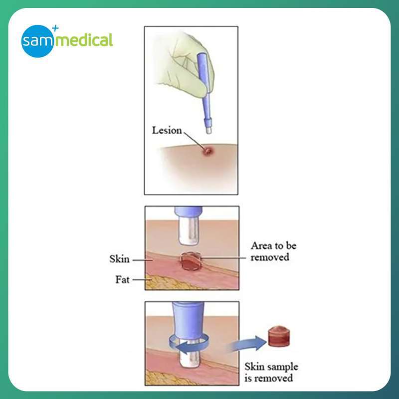 Jual Medax Efitheasy Biopsy Punch / Disposable Biopsi - Satuan ...