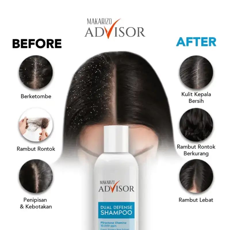 Promo Makarizo Advisor Clinical Shampoo Dual Defense 200ml Ketombe ...