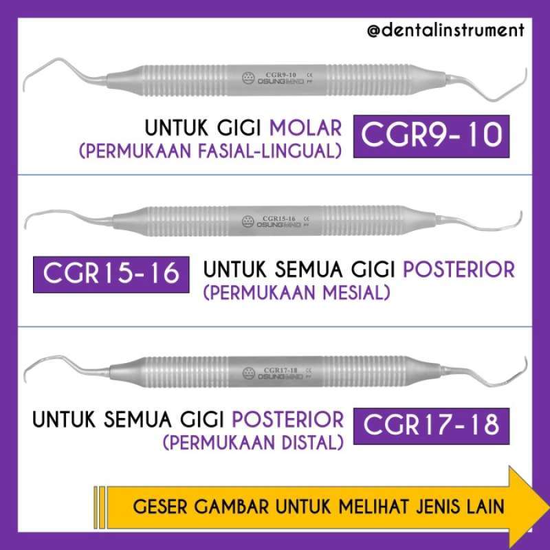 Promo Gracey Curettes / Kuret Gracey Merek Osung Dalam Berbagai Tipe ...