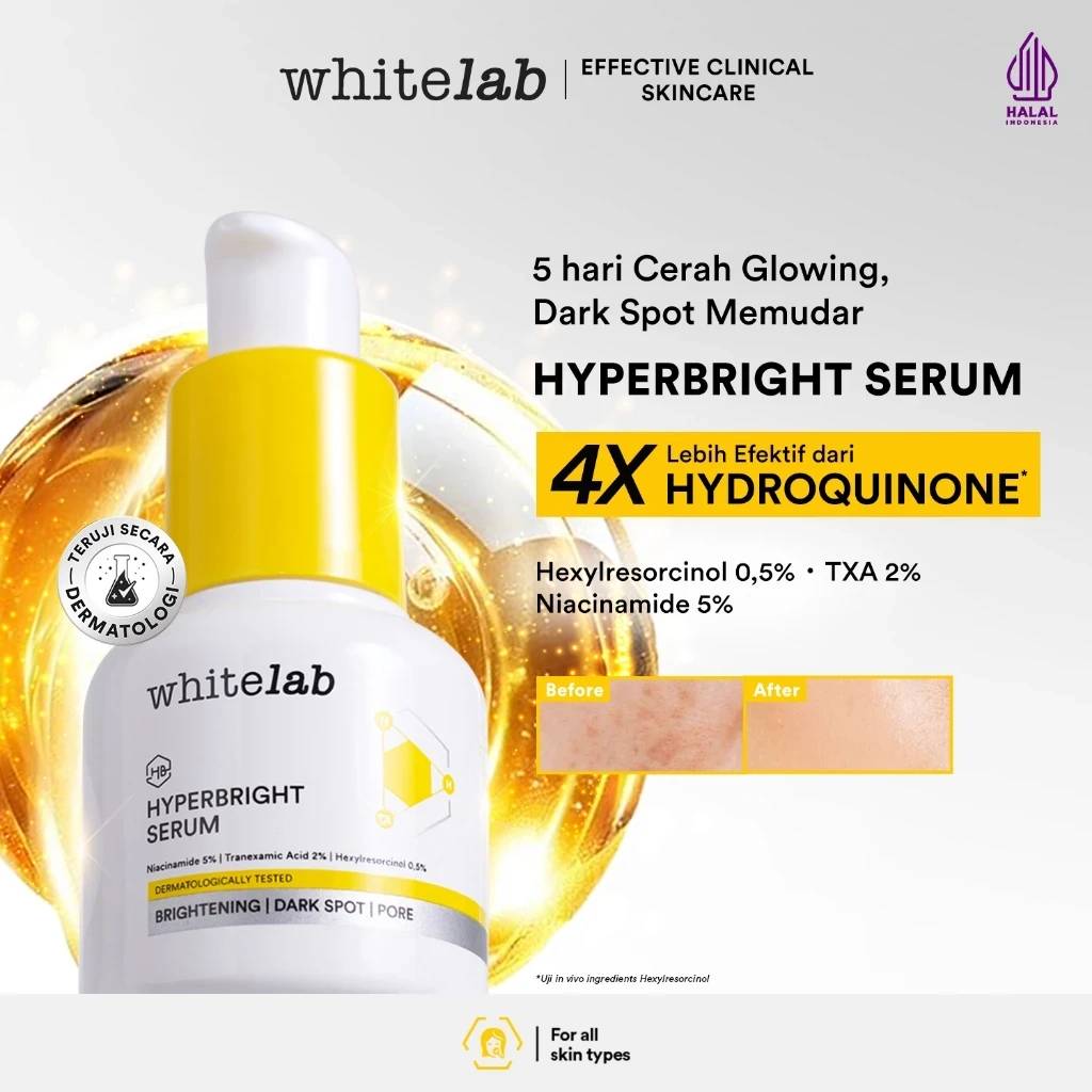 Promo [new Launch] Whitelab Hyperbright Brightening Serum - Serum ...