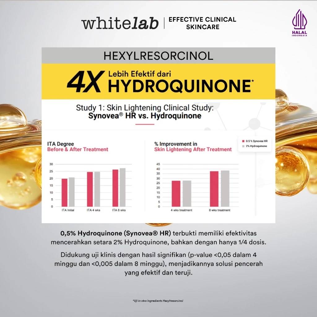 Promo [new Launch] Whitelab Hyperbright Brightening Serum - Serum ...